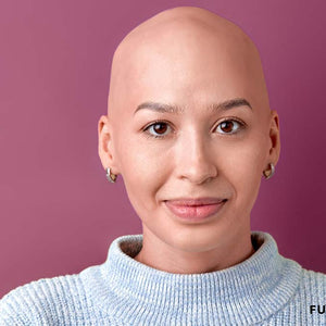 Alopecia Totalis: Understanding And Stimulating Hair Growth | FullyVital