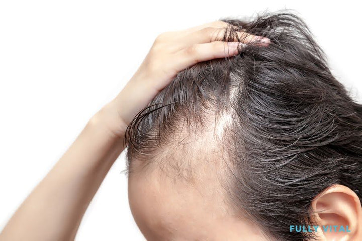 Say Goodbye To Worries: Solutions For A Bad Hairline | FullyVital