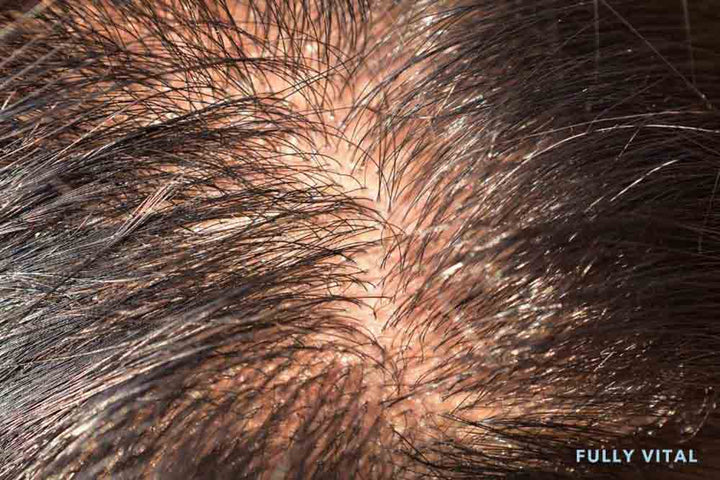 Unlocking The Secrets Of Club Hair: Your Guide To Healthy Hair Growth ...