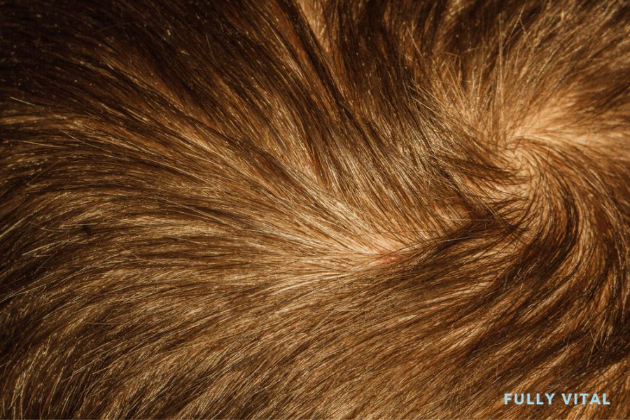 Understanding Hair Whorl: A Key To Hair Growth | FullyVital