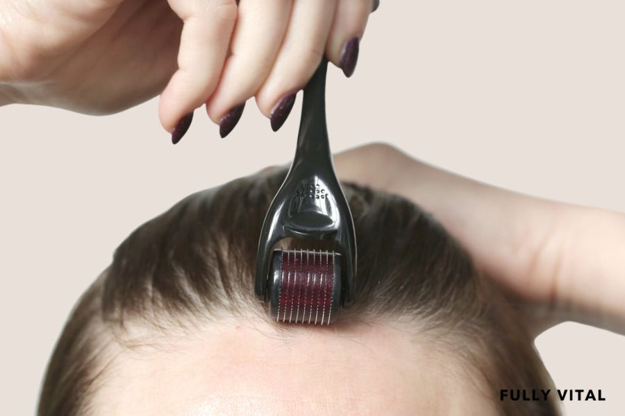 Microneedling Hairline: Stimulate Hair Growth With This Game-Changing ...