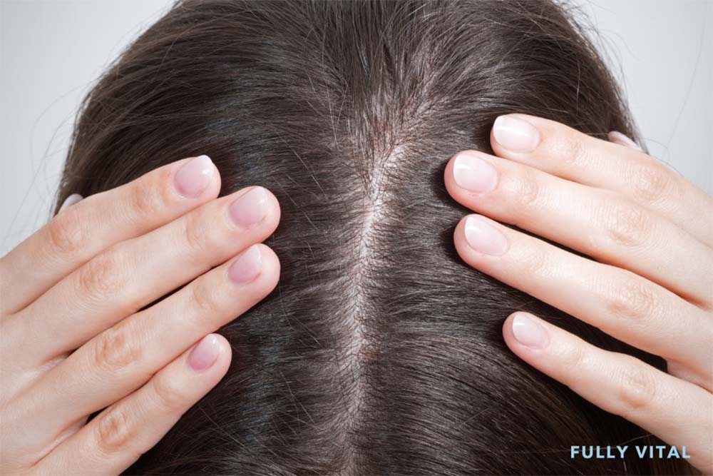 Types of Hairlines: Everything You Need to Know | FullyVital