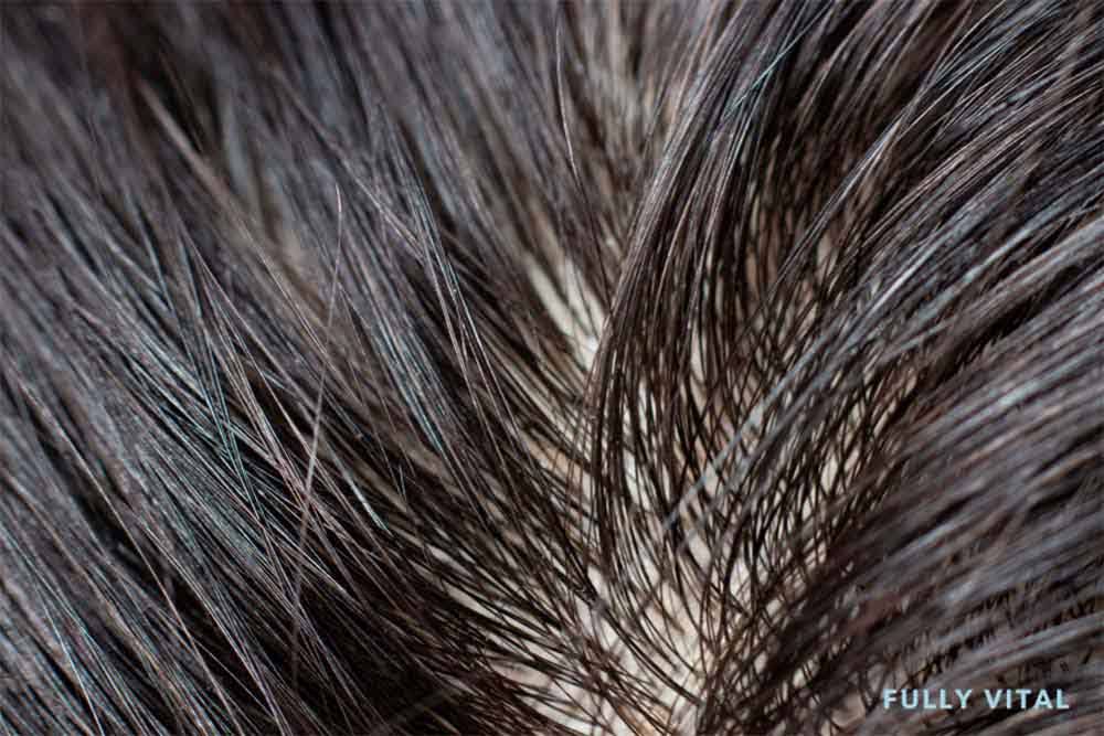 From Diet to Hormones: Exploring the Hidden Causes of Greasy Hair ...