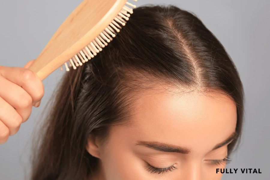 Early Receding Hairline: A Comprehensive Guide For Women | FullyVital