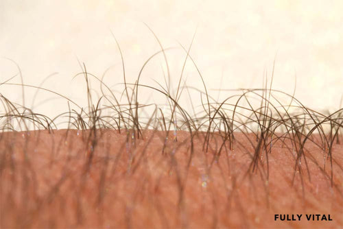 Understanding Vellus Hair: Your Comprehensive Guide