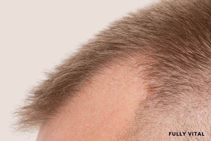 All About The Hair Shaft: Understanding Its Role In Hair Growth ...