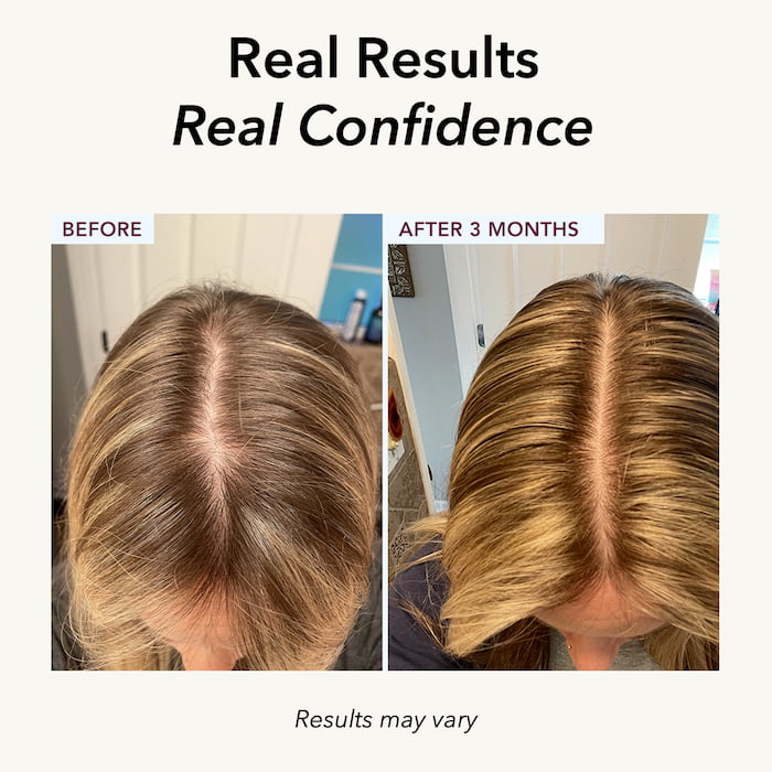 Three-Month Hair Growth Bundle | Regrow Hair | FullyVital